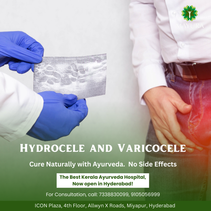 Understanding Hydrocele and Varicocele: Causes, Symptoms, and Effective ...