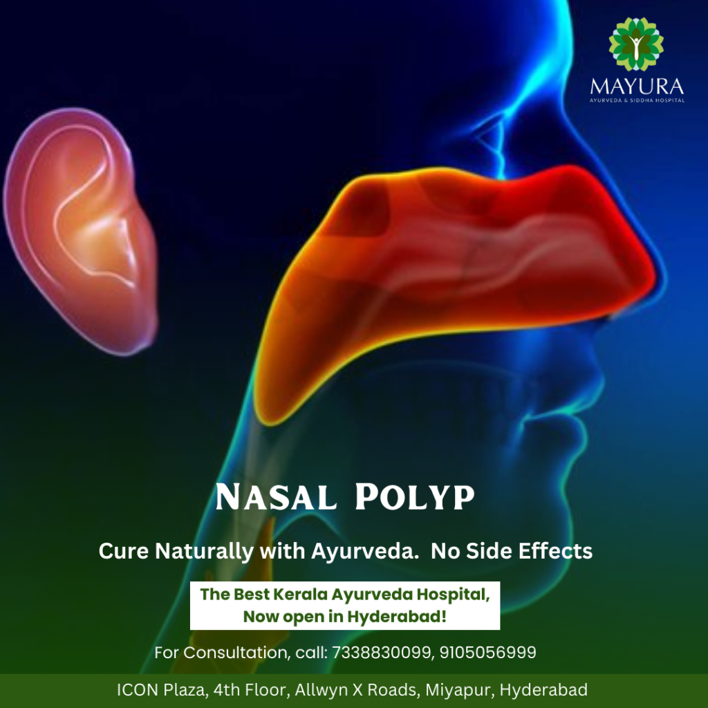 Understanding Nasal Polyps: Causes, Symptoms, and Treatment Options ...