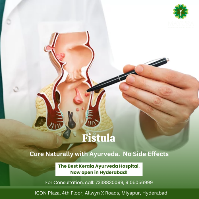 Understanding Fistula: Causes, Symptoms, and Treatment - Mayura Hospitals