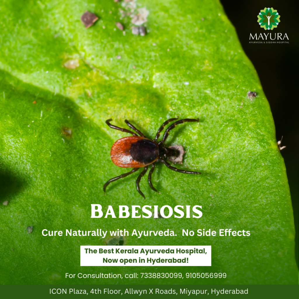 Comprehensive Guide to Babesiosis Management: Symptoms, Treatment, and ...
