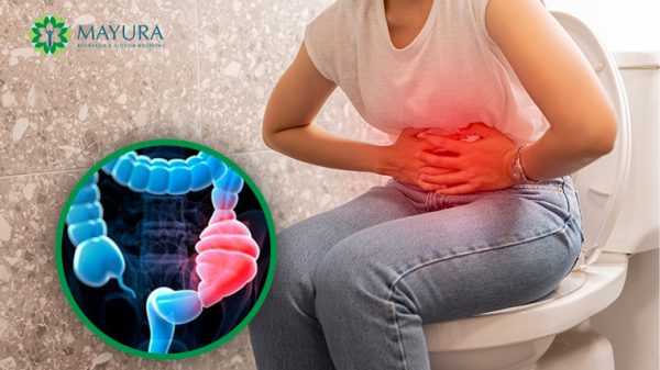 Constipation - Mayura Hospitals