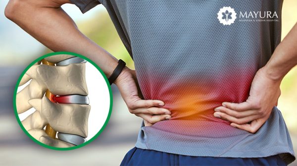 Disc Bulge - Mayura Hospitals